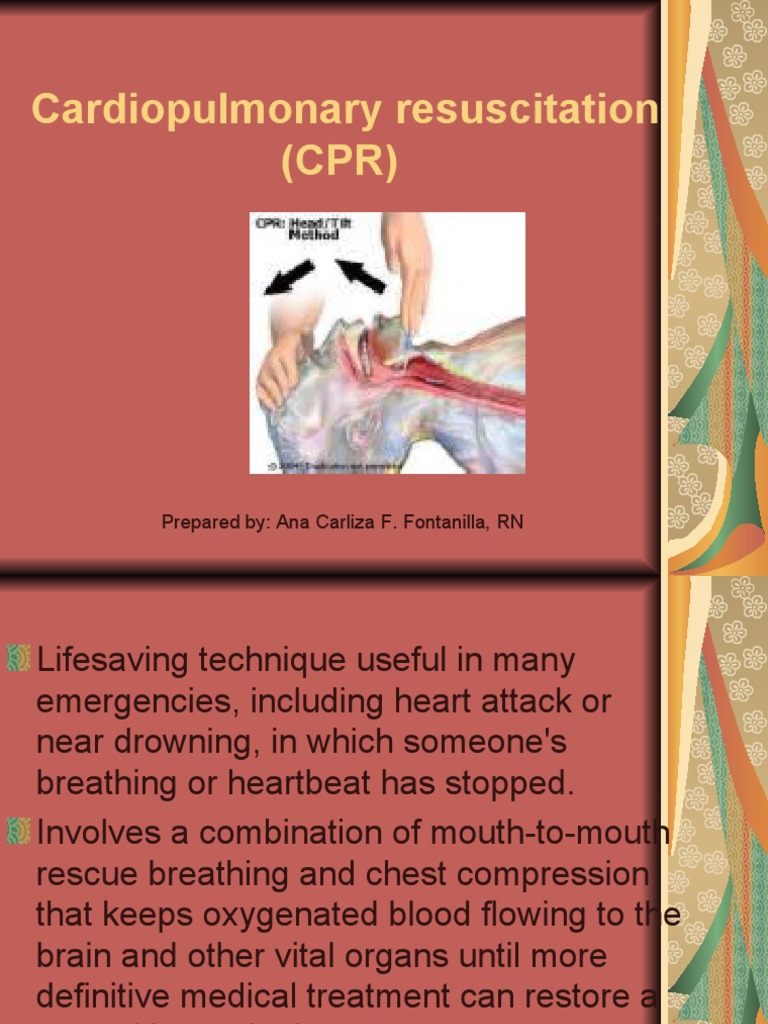 Cardiopulmonary Resuscitation (CPR) : Prepared By: Ana Carliza F ...