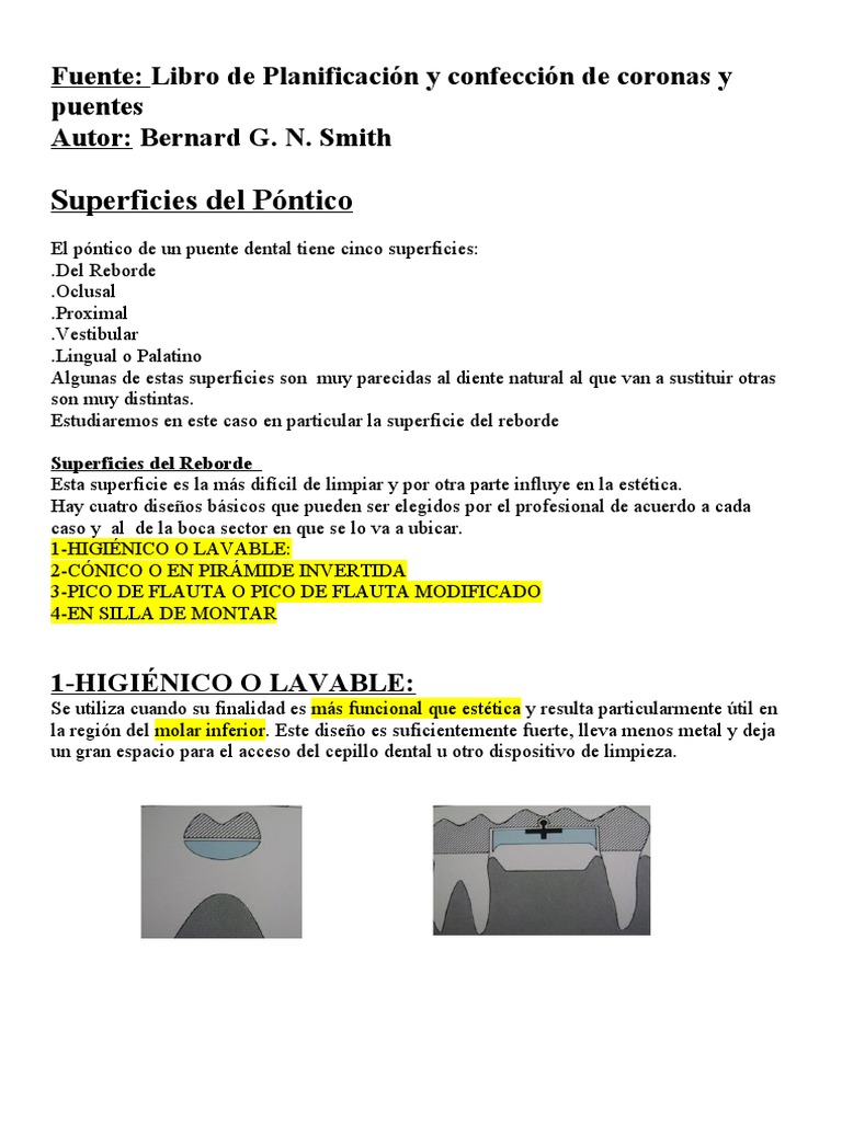 Tipos de Pónticos Dentales en Odontología | PDF | Diente | Dentadura ...