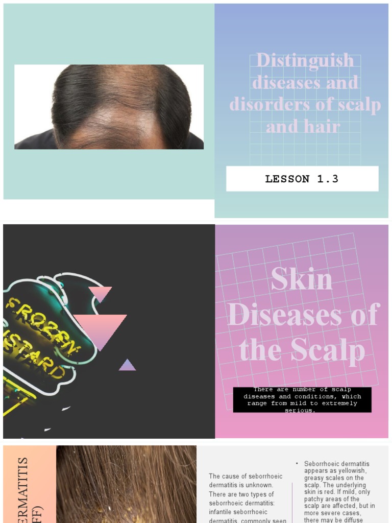 DAY 3.distinguish Diseases and Disorders of Scalp and Hair | Download ...