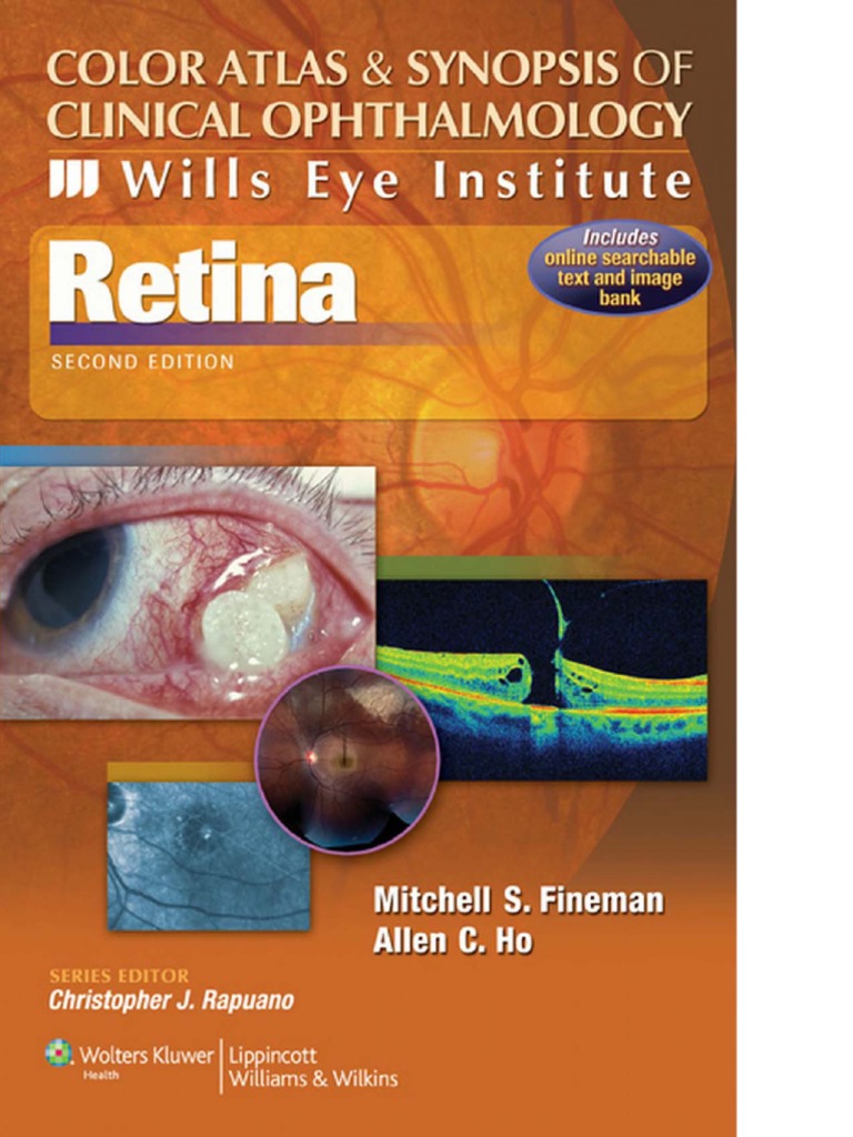Color Atlas and Synopsis of Clinical Ophthalmology - Retina 2012 | PDF ...