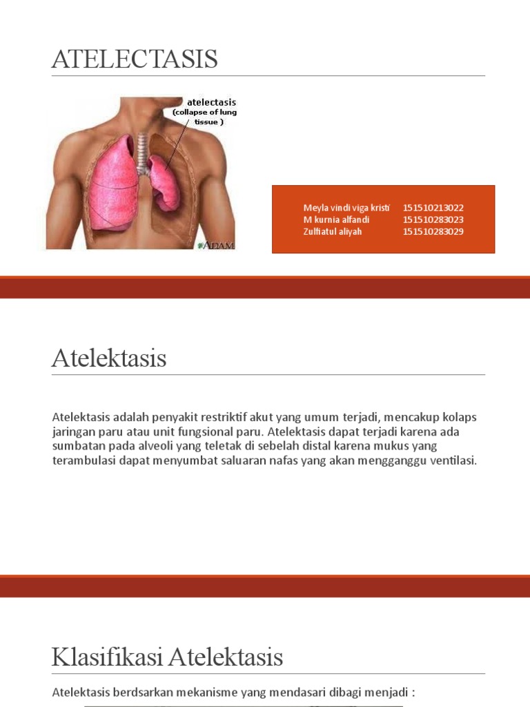 Atelektasis Baru | PDF