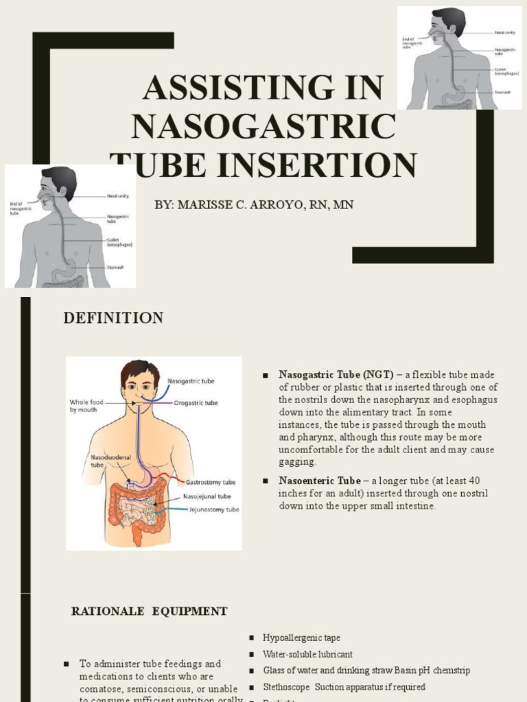 NGT Insertion Guide: 40 Steps for Safe Placement | PDF | Medical ...