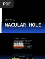 Papilledema Grading System (Frisen Scale) | PDF
