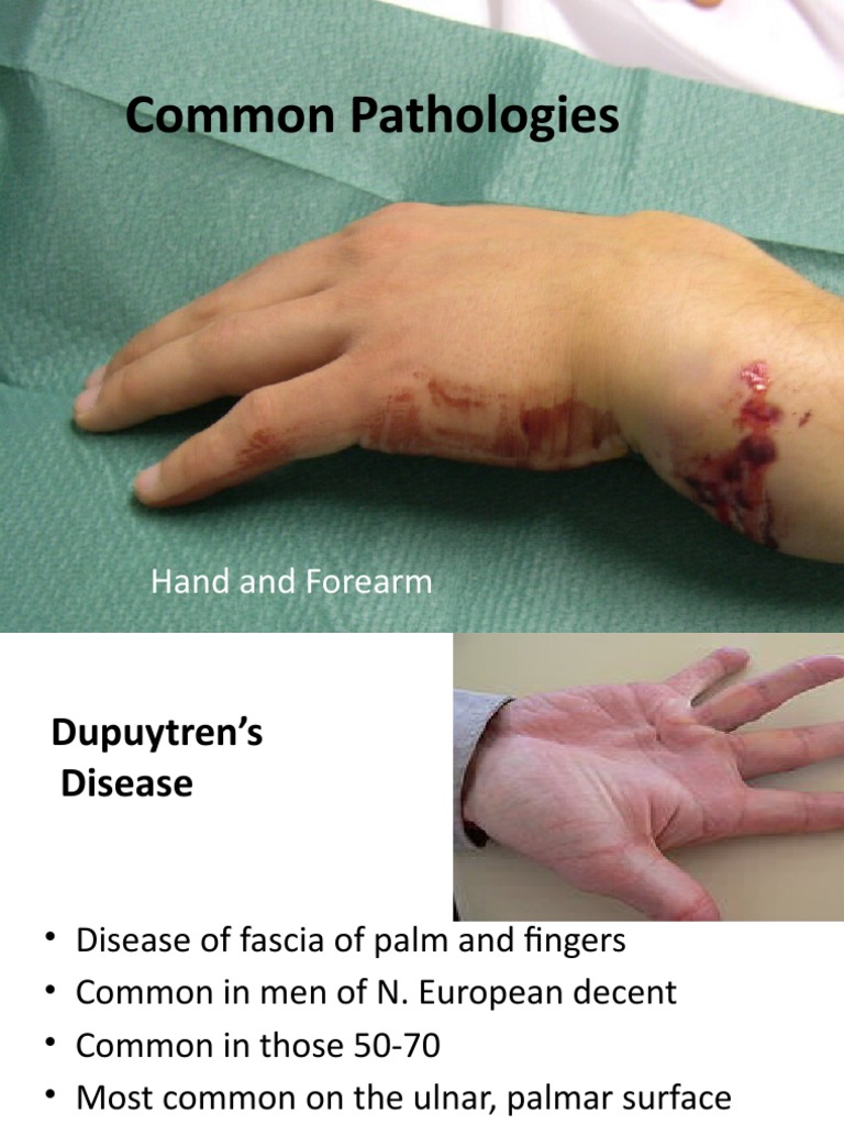 Common Pathologies: Hand and Forearm | PDF