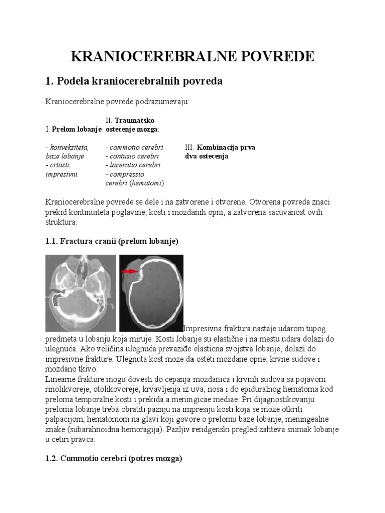 Kraniocerebralne Povrede | PDF