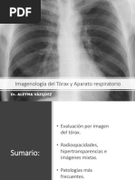 Cómo leer una radiografía de tórax | PDF | Tórax | Tórax (anatomía humana)