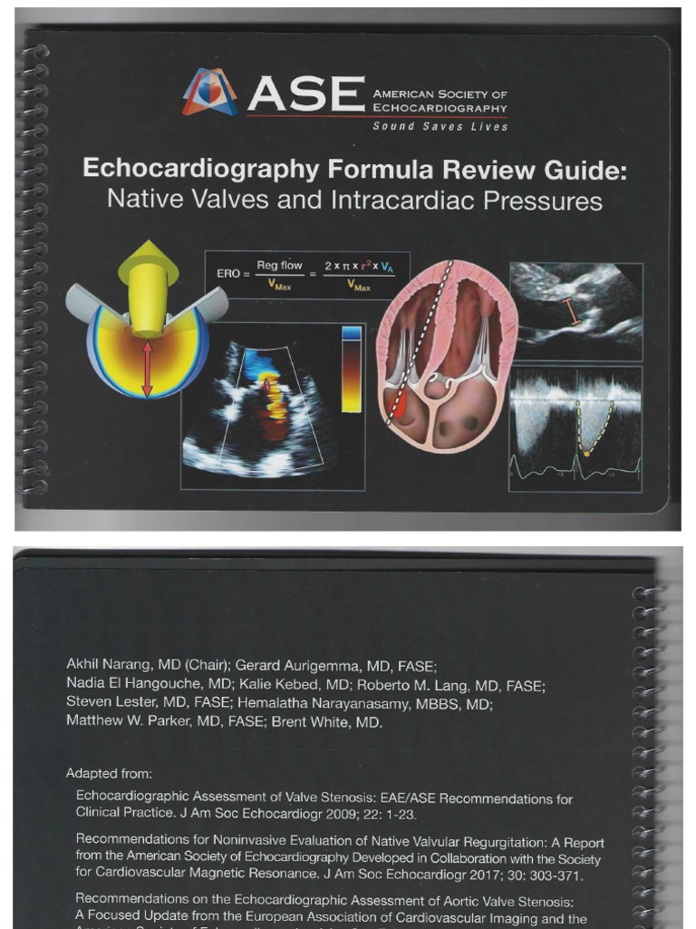 ASE Echo Formula | PDF