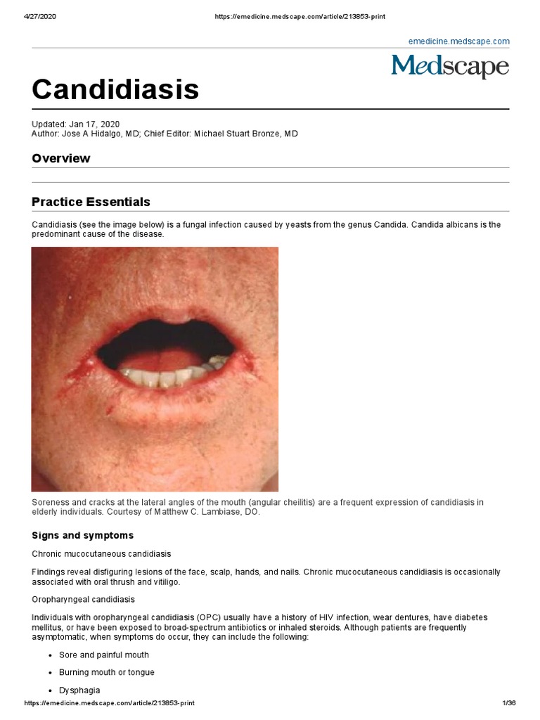 Candidiasis Medscape | PDF | Candidiasis | Candida (Fungus)