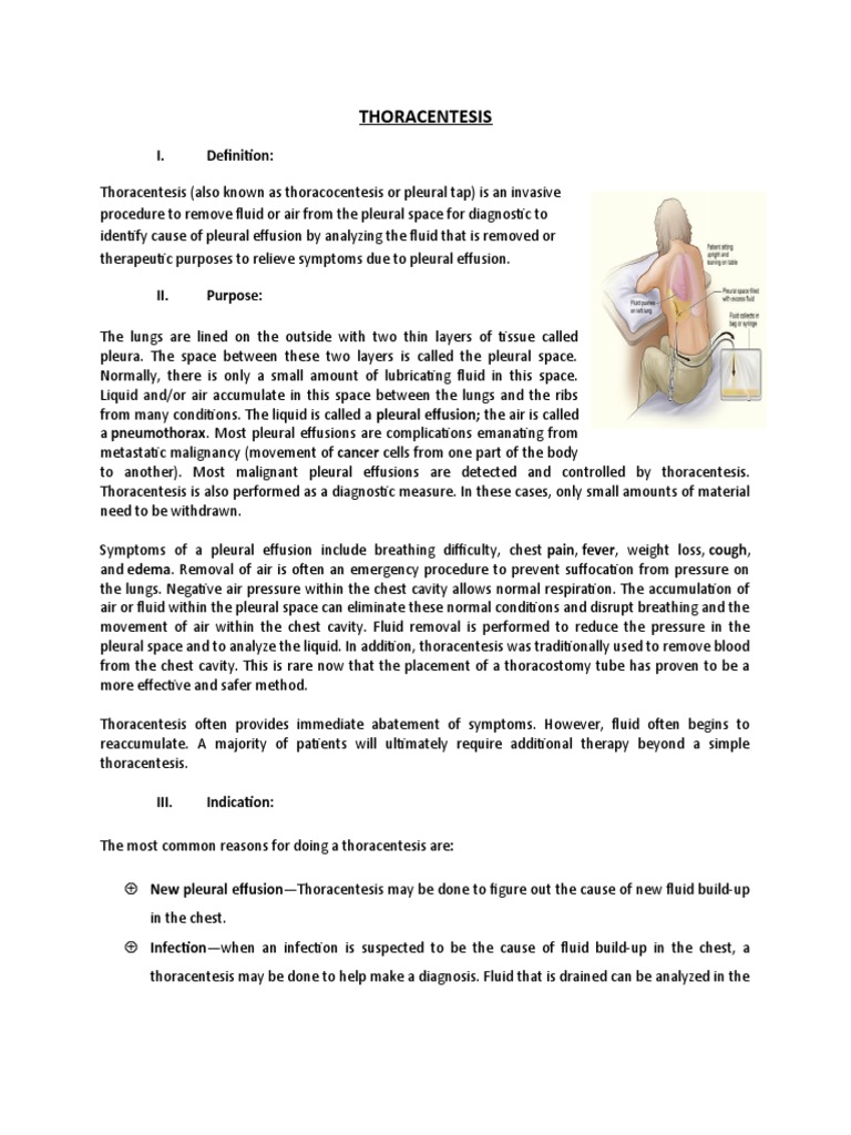 THORACENTESIS | PDF | Medical Specialties | Diseases And Disorders