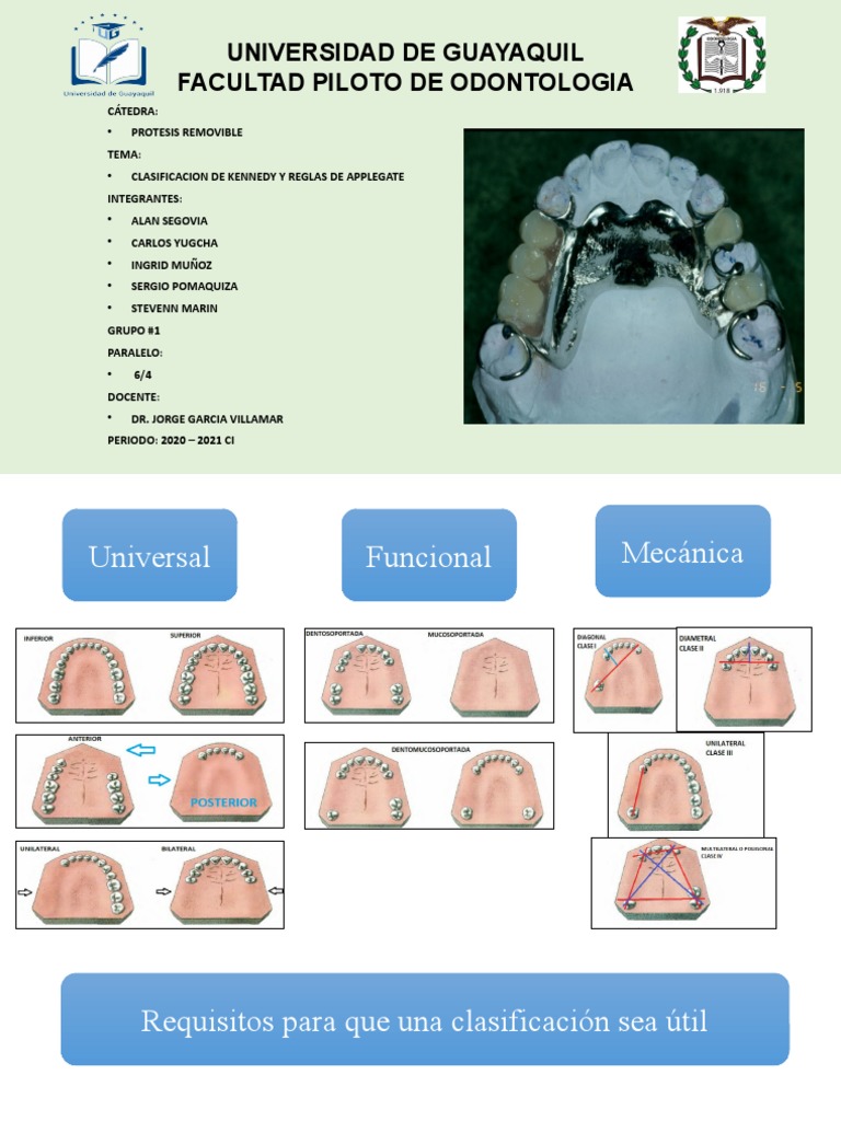 Grupo 1 Clasificacion de Kennedy, Reglas de Applegate | PDF | Dentadura ...