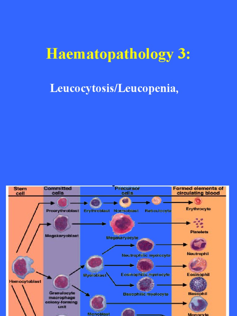 Haematopathology 3:: Leucocytosis/Leucopenia | PDF | White Blood Cell ...