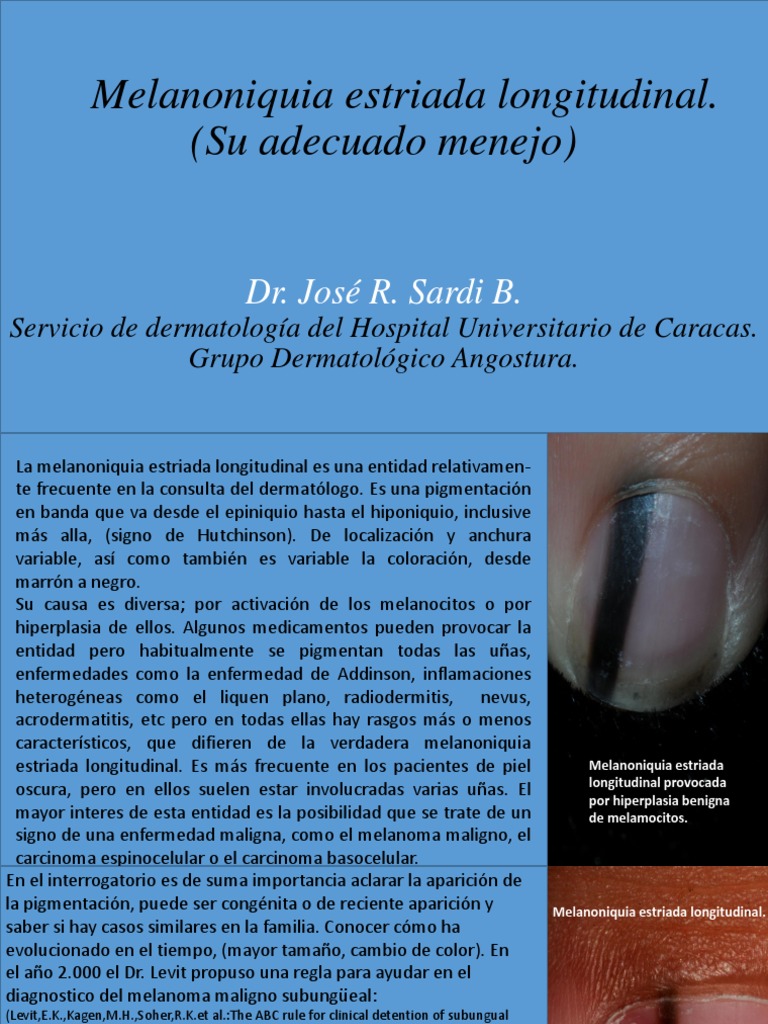 Melanoniquia Estriada Longitudinal | PDF | Melanoma | Condiciones cutáneas