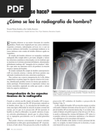 Prueba de Adams | PDF | La columna vertebral | Escoliosis