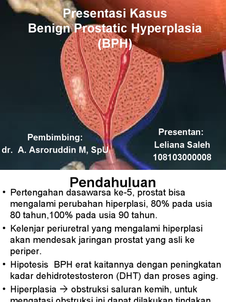 Presentasi Kasus BPH | PDF