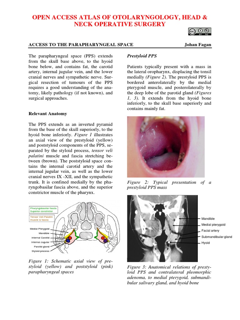 Anatomy and Access to Parapharyngeal Space | PDF | Common Carotid ...