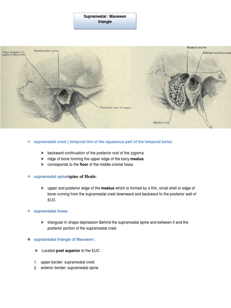 spine of Henle: Suprameatal / Macewen Triangle | PDF
