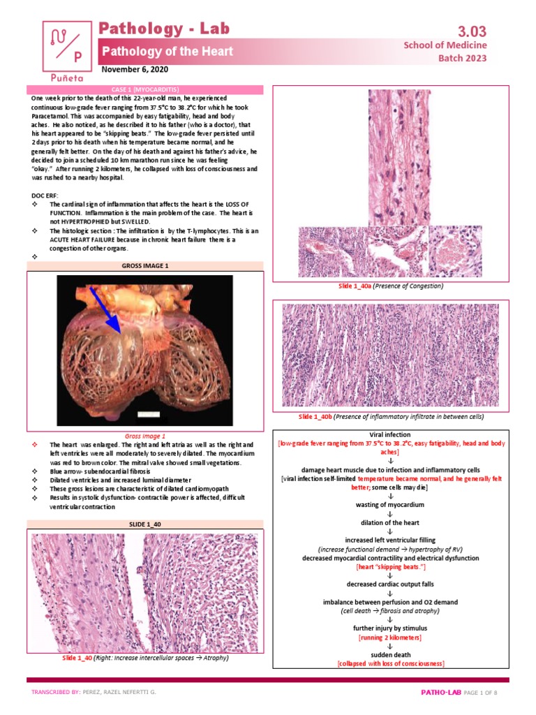 PATHOL - 3.03 - Pathology of The Heart | PDF | Myocardial Infarction ...