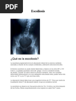 Test de Adams | PDF | Escoliosis | Especialidades Medicas
