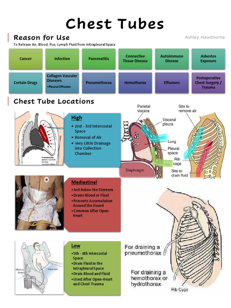 Chest Tubes: Reason For Use | PDF | Thorax | Medicine