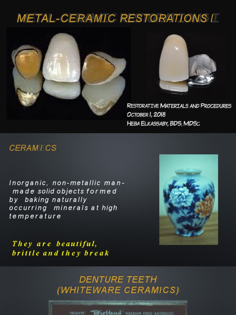 12-Metal-Ceramic Restorations | PDF | Sintering | Thermal Expansion