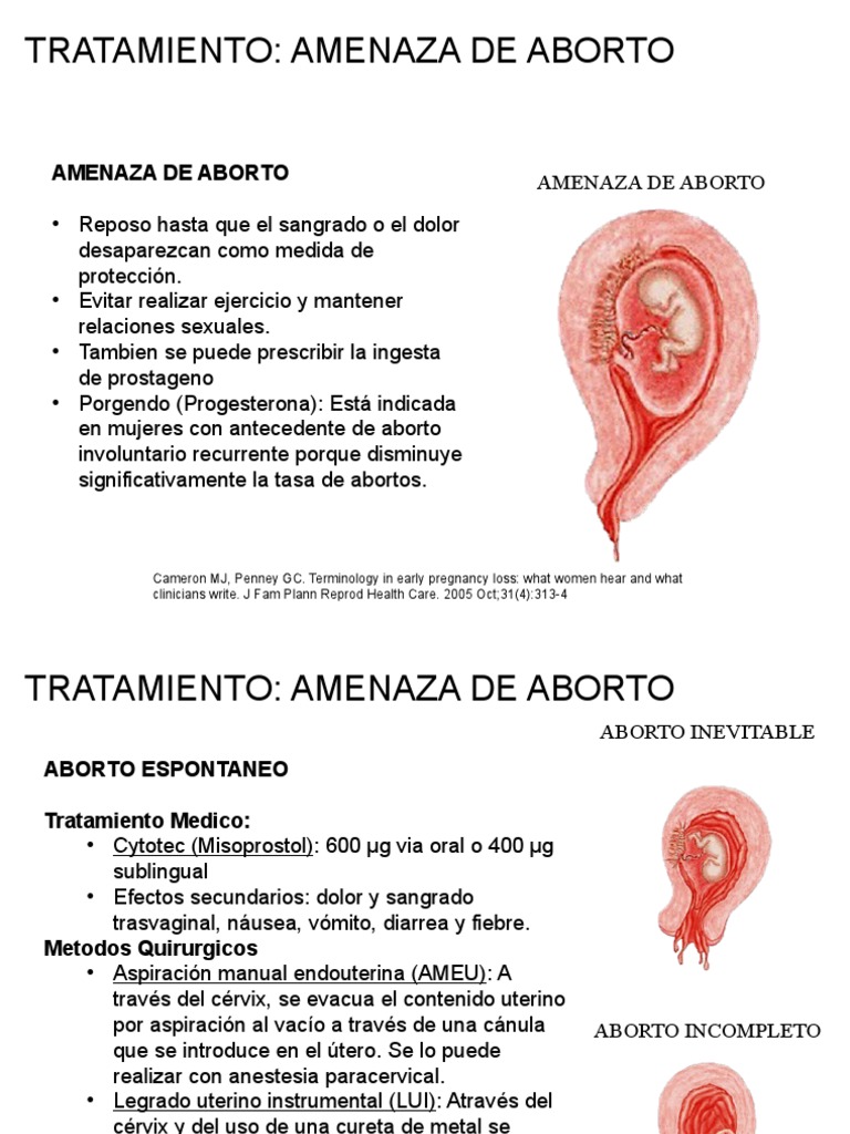 Diapo Lois Aborto | PDF | Aborto espontáneo | Salud maternal