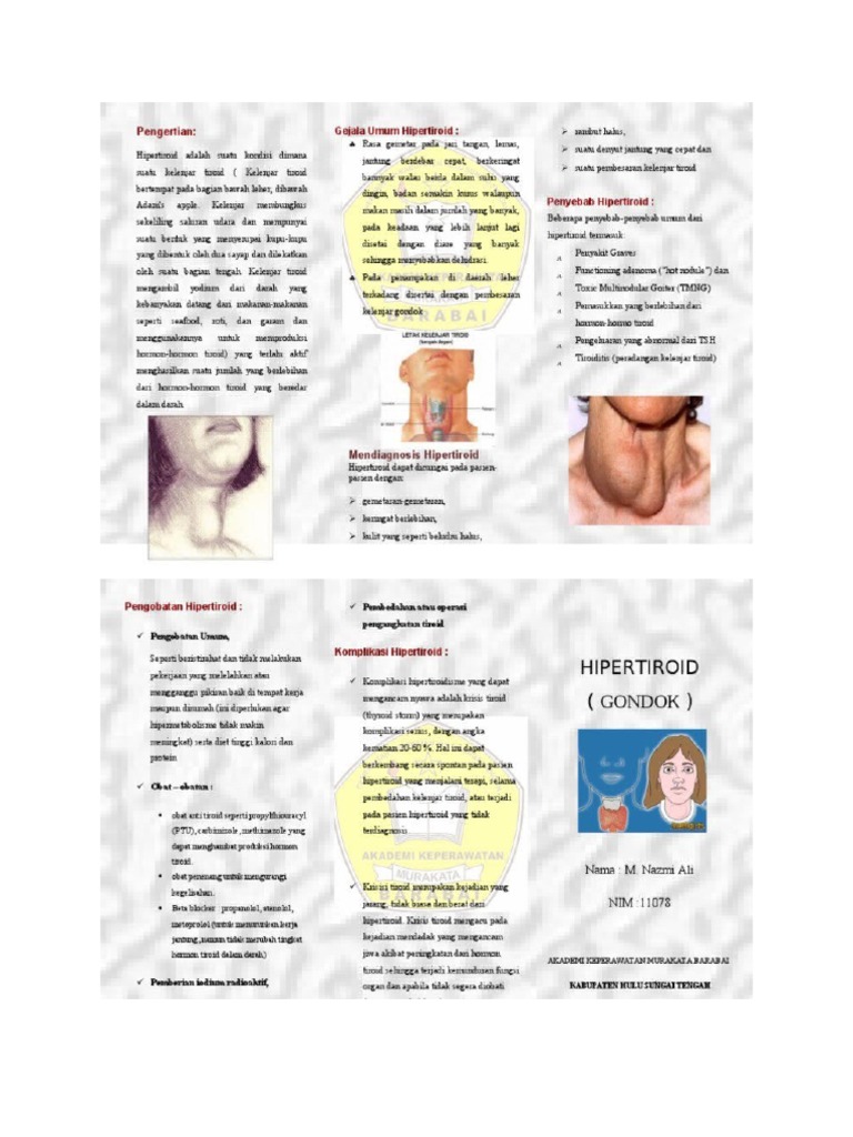 Leaflet Hipertiroid | PDF
