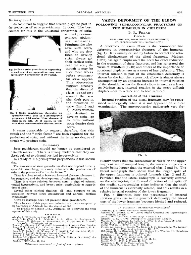 Varus Osteotomy French 1959 | PDF | Musculoskeletal System | Human Anatomy