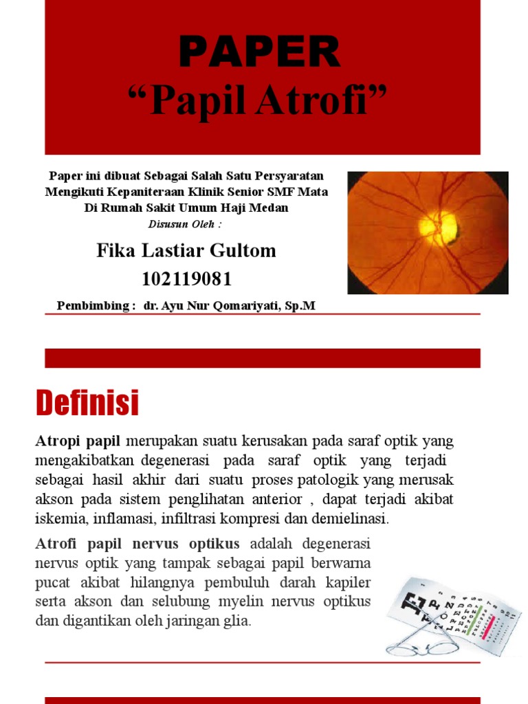 Atrofi Papil Fika | PDF