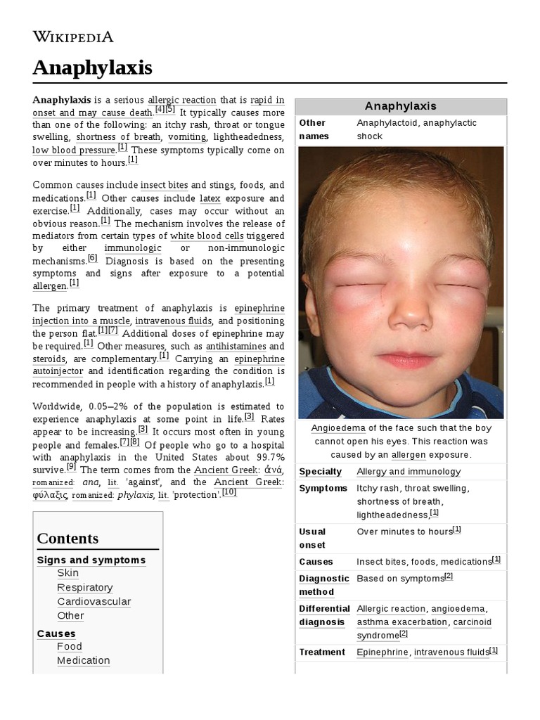Anaphylaxis: Anaphylaxis Is A Serious Allergic Reaction That Is Rapid ...