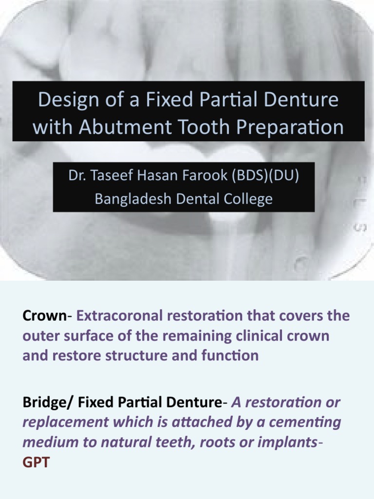 Fixed Partial Denture Design Guide | PDF | Human Tooth | Dental Implant