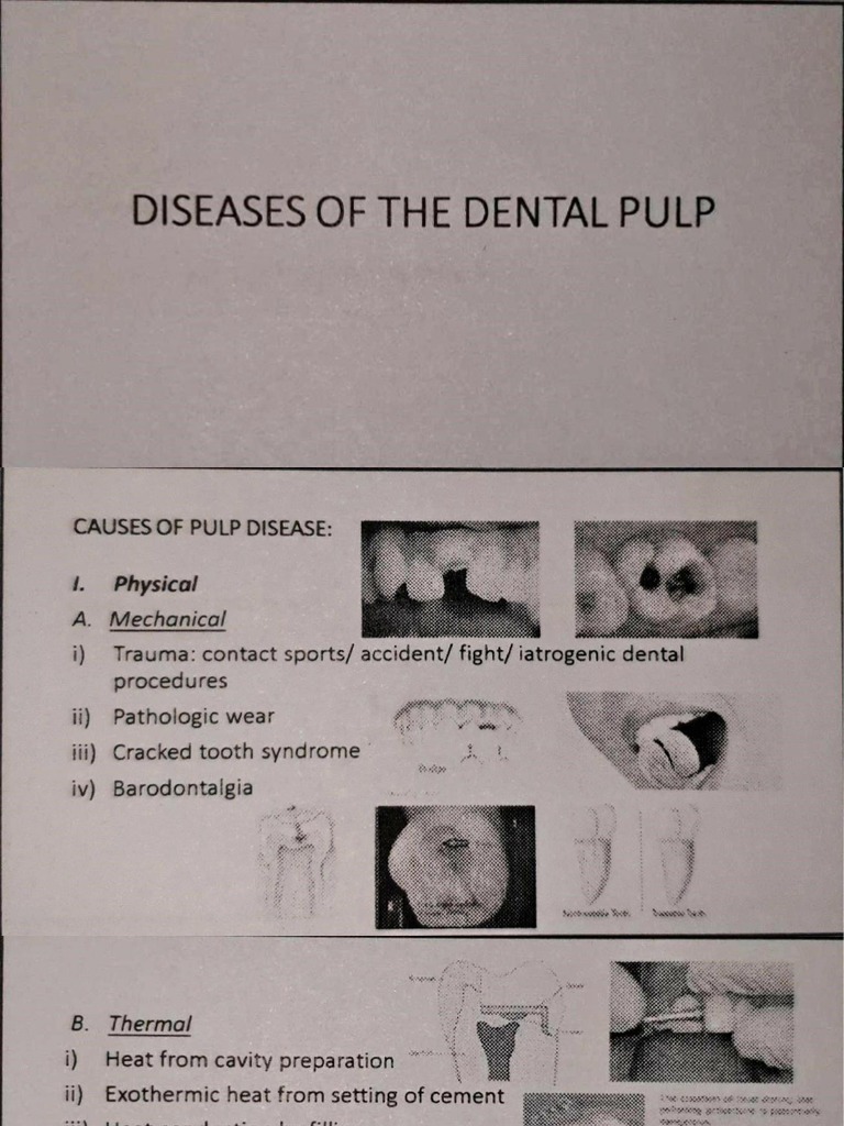 Diseases of The Dental Pulp | PDF | Dentistry | Mouth