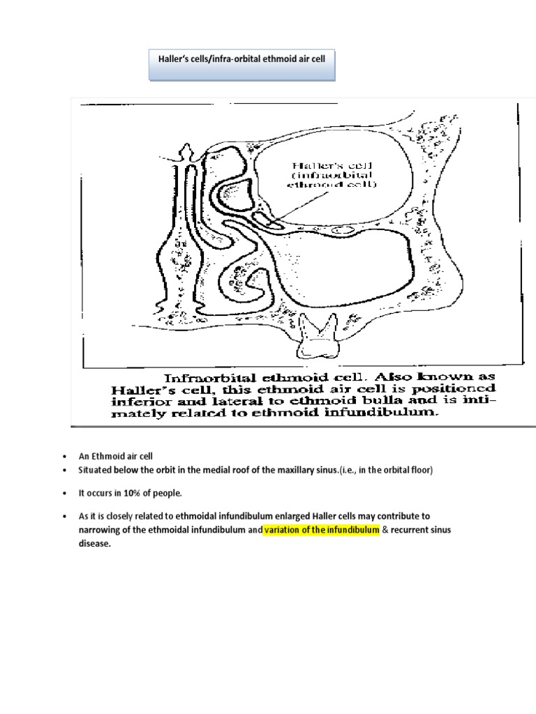Haller S Cells/infra-Orbital Ethmoid Air Cell | PDF
