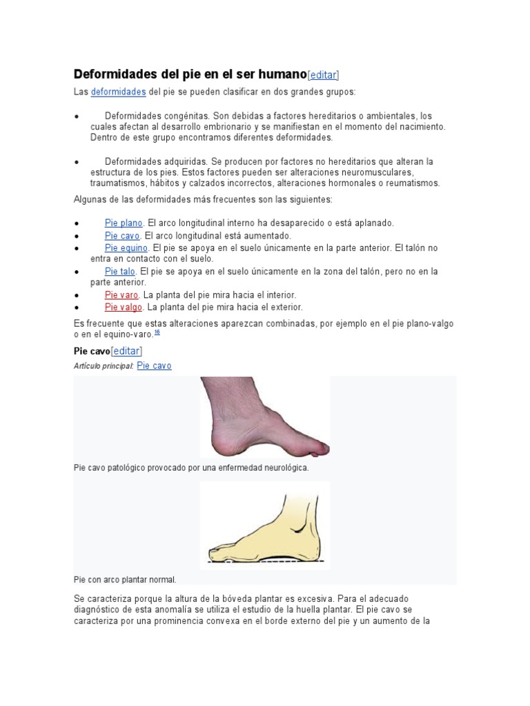 Maformacion Del Pie | PDF | Pie | Enfermedades y trastornos humanos