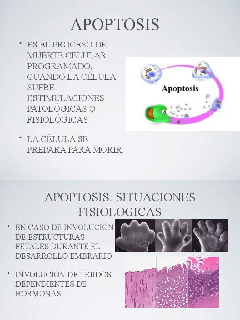 Apoptosis: Muerte Celular Programada | PDF