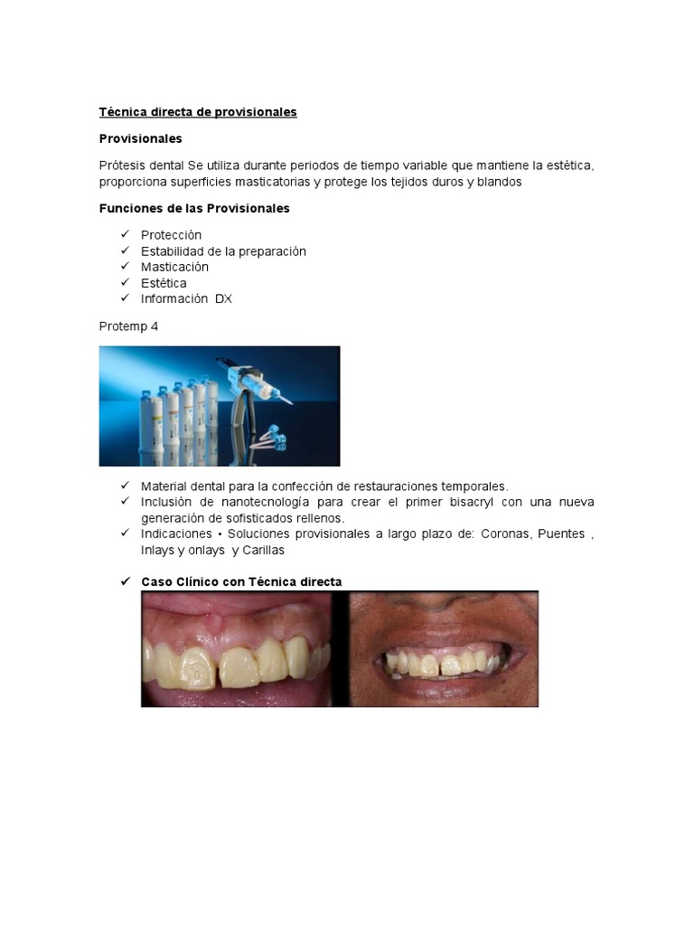Técnica Directa de Provisionales | PDF