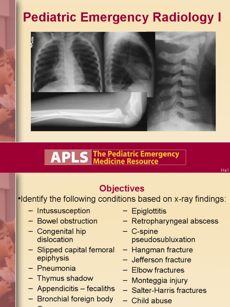 Pediatric Emergency Radiology I | PDF | Elbow | Musculoskeletal System