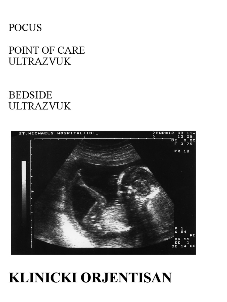 Pocus Point of Care Ultrazvuk Bedside Ultrazvuk | PDF | Lung | Respiration