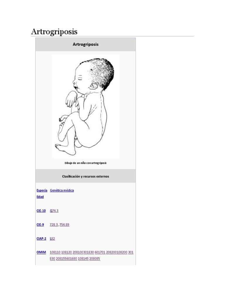Artrogriposis Múltiple Congénita: Guía | PDF | Sistema ...