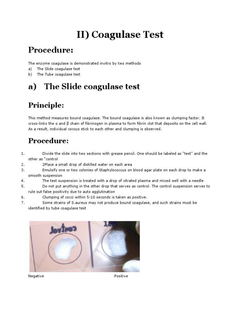 II) Coagulase Test: Procedure | Download Free PDF | Microbiology ...