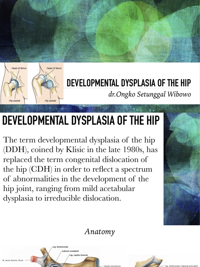 DDH - Developmental Dysplasia of The Hip | PDF | Medical Imaging | Hip