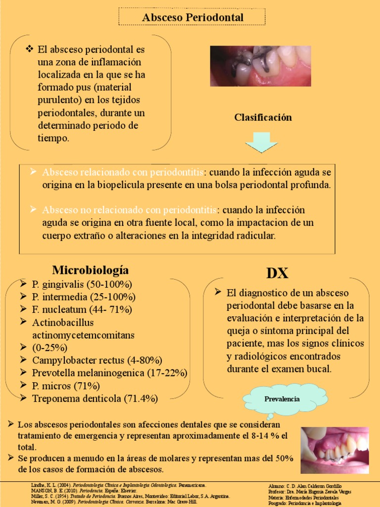 Absceso Periodontal. | PDF | Inmunología | Especialidades Medicas