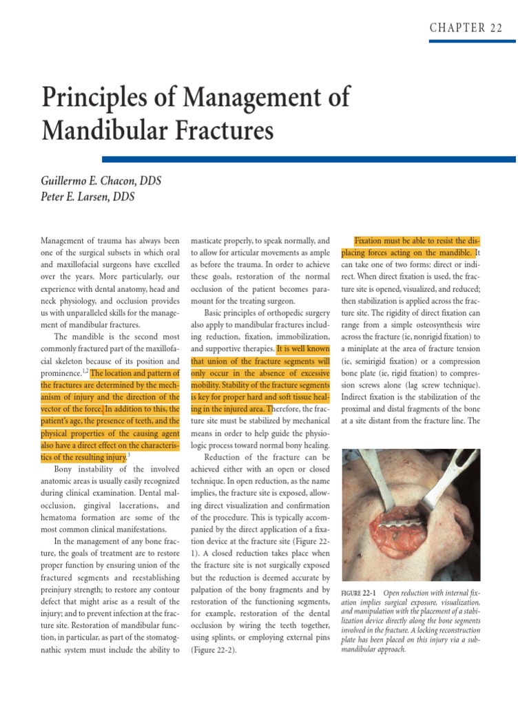 22 Management of Mandibular Fractures | PDF | Mouth | Clinical Medicine
