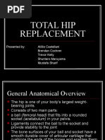 015 Exeter V40 Femoral Stem Using Modular Broach Surgical Technique For ...