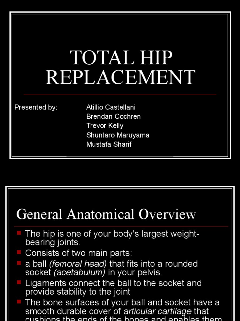 Total Hip Replacement Overview | PDF | Hip | Osteoarthritis