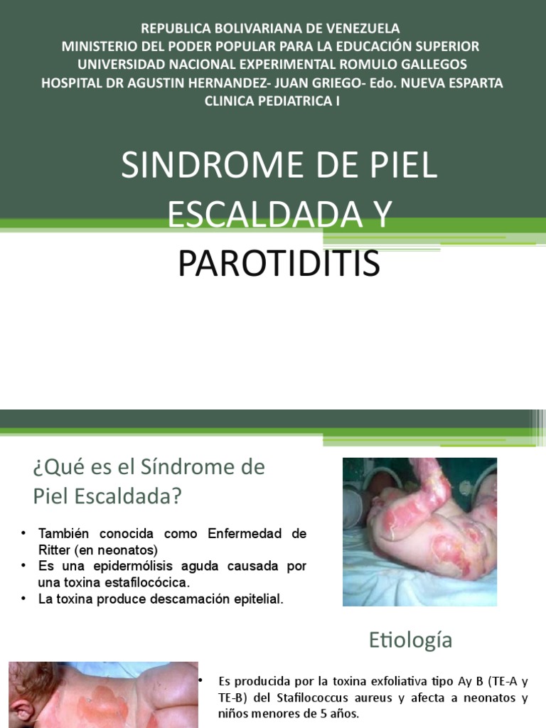 Piel Escaldada | PDF | Rtt | Microbiología
