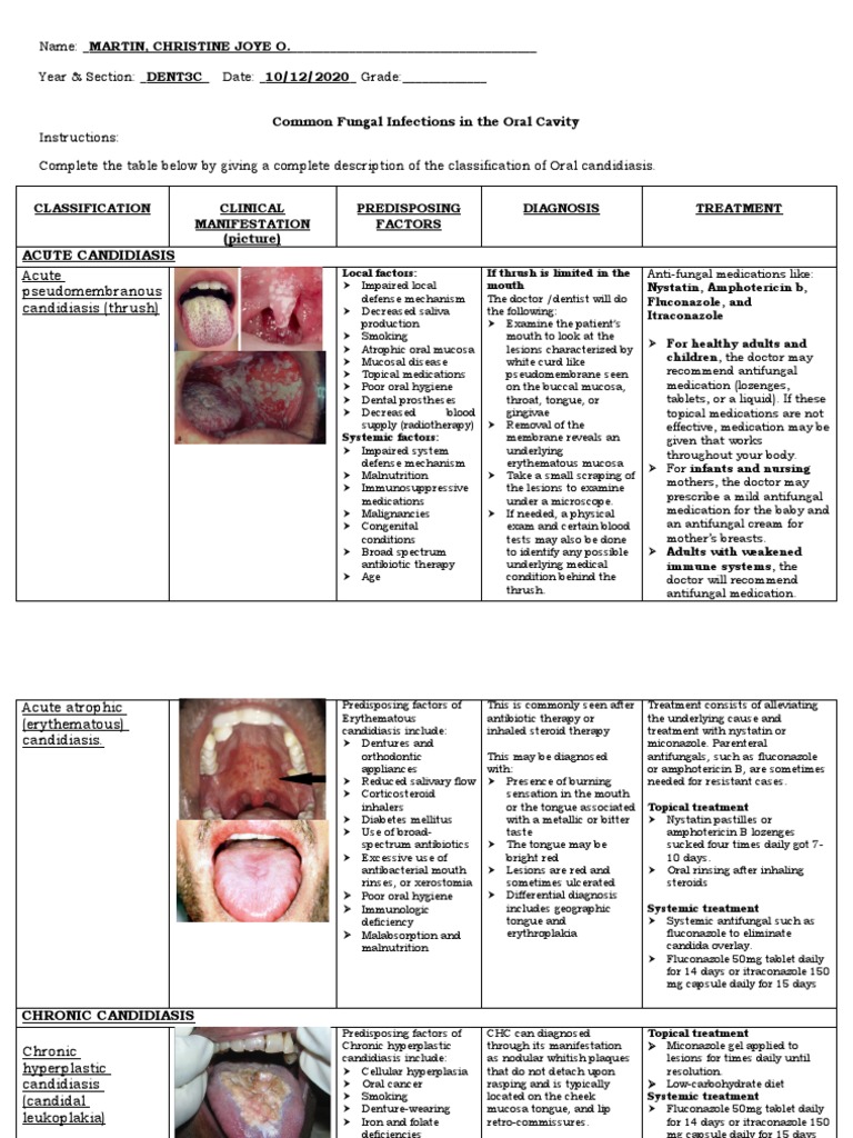 Common Fungal Infections in The Oral Cavity: Acute Candidiasis | PDF ...