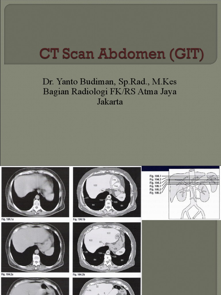 Kuliah Blok GI Tract CT Scan Abdomen Agustus 2010 | PDF | Liver | Pancreas