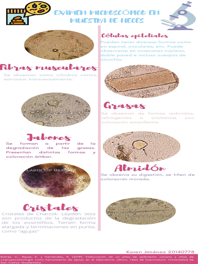 EXAMEN MICROSCÓPICO EN HECES | PDF | Sistema urinario | Riñón