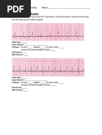Reading The Holter ECG Report | PDF | Electrocardiography | Cardiac ...