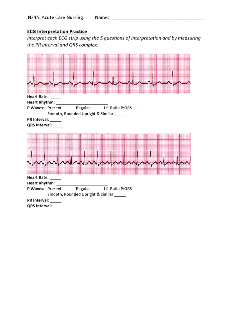 ECG Interpretation Practice | PDF | Electrocardiography | Internal Medicine